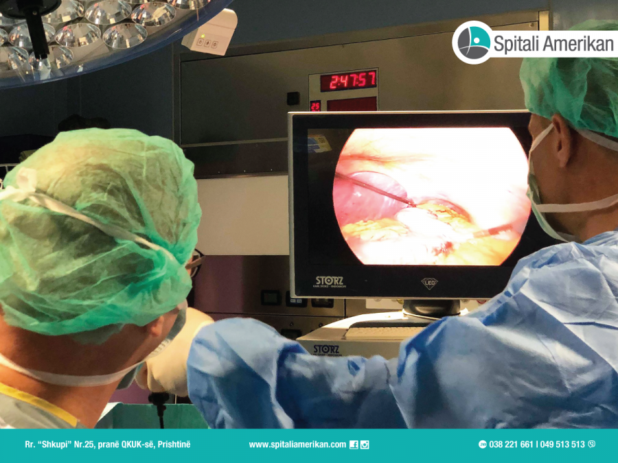 Largojeni peshën e tepërt me trajtimin Laparoskopik Mini Invazive në ...